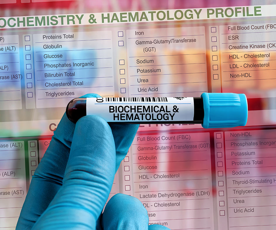 Bone Profile Blood Test Cost Bone Health Blood Test Bone Profile Blood Test Cost Bone Health Blood Test