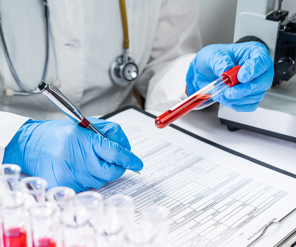 Bone Profile Blood Test Cost Bone Health Blood Test Bone Profile Blood Test Cost Bone Health Blood Test